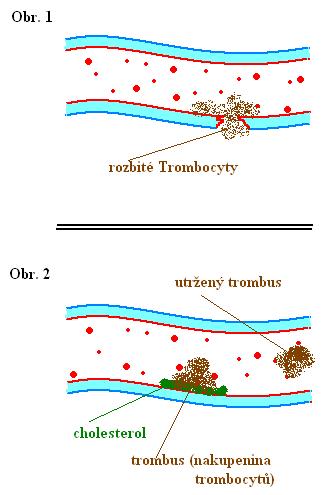 TROMBOCYTY :: Somatologie pro SZŠ